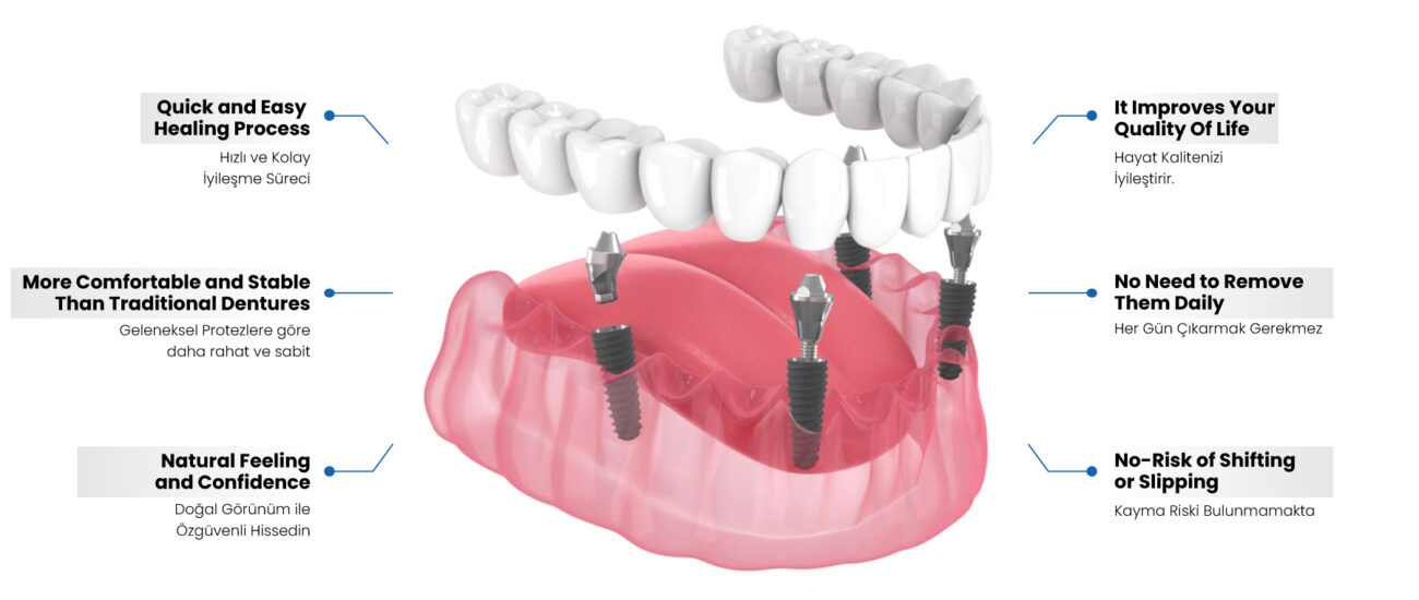 Multi-Unit Solutions - macrosimplant.com.tr